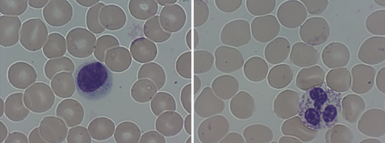 New Frontier of Blood and Inflammation with Prof. Johannes Schmid