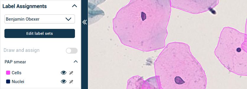 Pathology Image Annotation Done Right